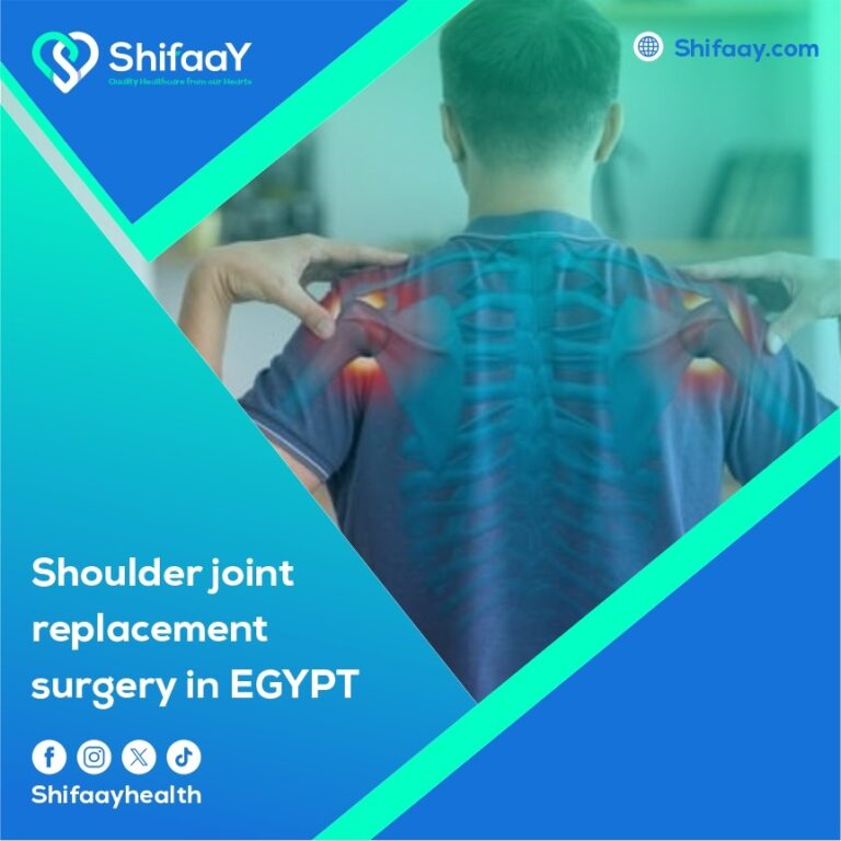 shoulder joint replacement surgery in egypt - Shifaay