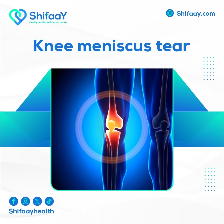 Knee meniscus tear - Shifaay