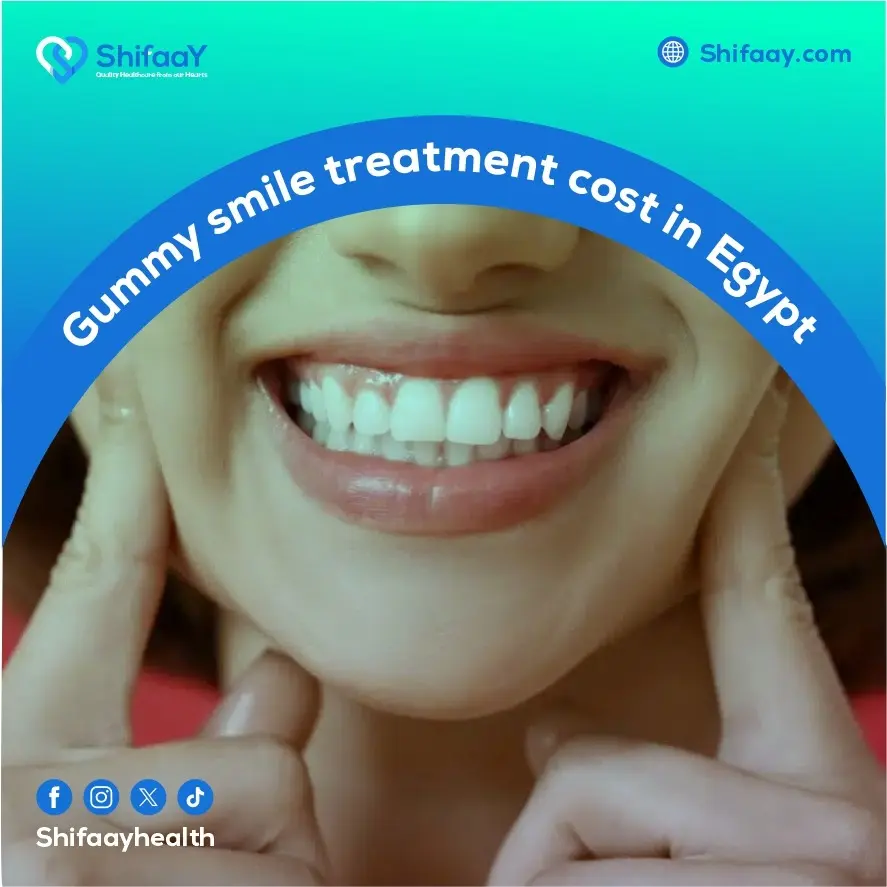 gummy smile treatment cost in Egypt - Shifaay